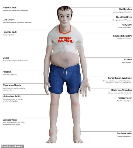 What Will Gamer's Bodies Look Like In The Future? Let's Discuss